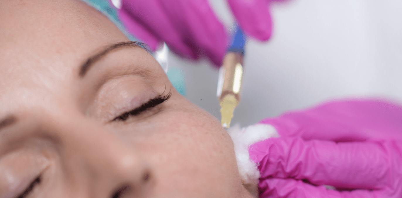 What Determines the Cost of Dermal Fillers Near Menifee, CA? - Nalan ...